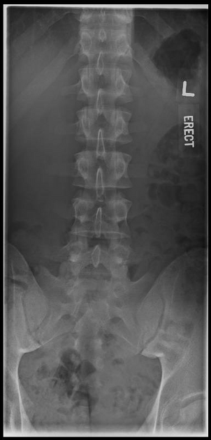 X-Ray Imaging - Draper Chiropractic